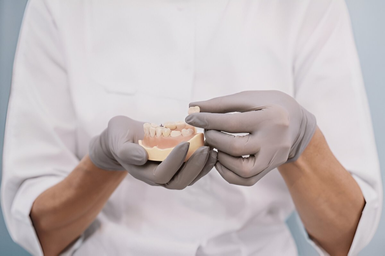 Dental Crowns in SW Edmonton | Dental Crowns Near You